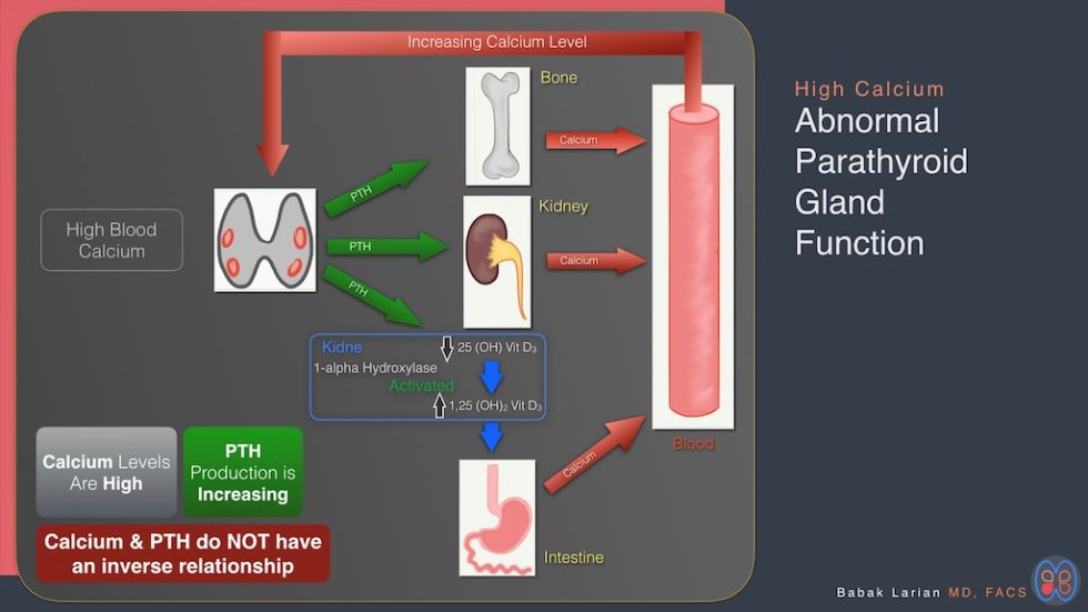 Hyperparathyroidism Diagnosis for Parathyroid Disease | Dr. Larian